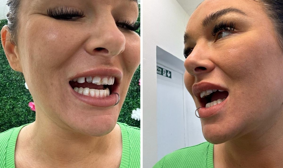 'My teeth were ruined on Harley Street – so I got the damage fixed in ...